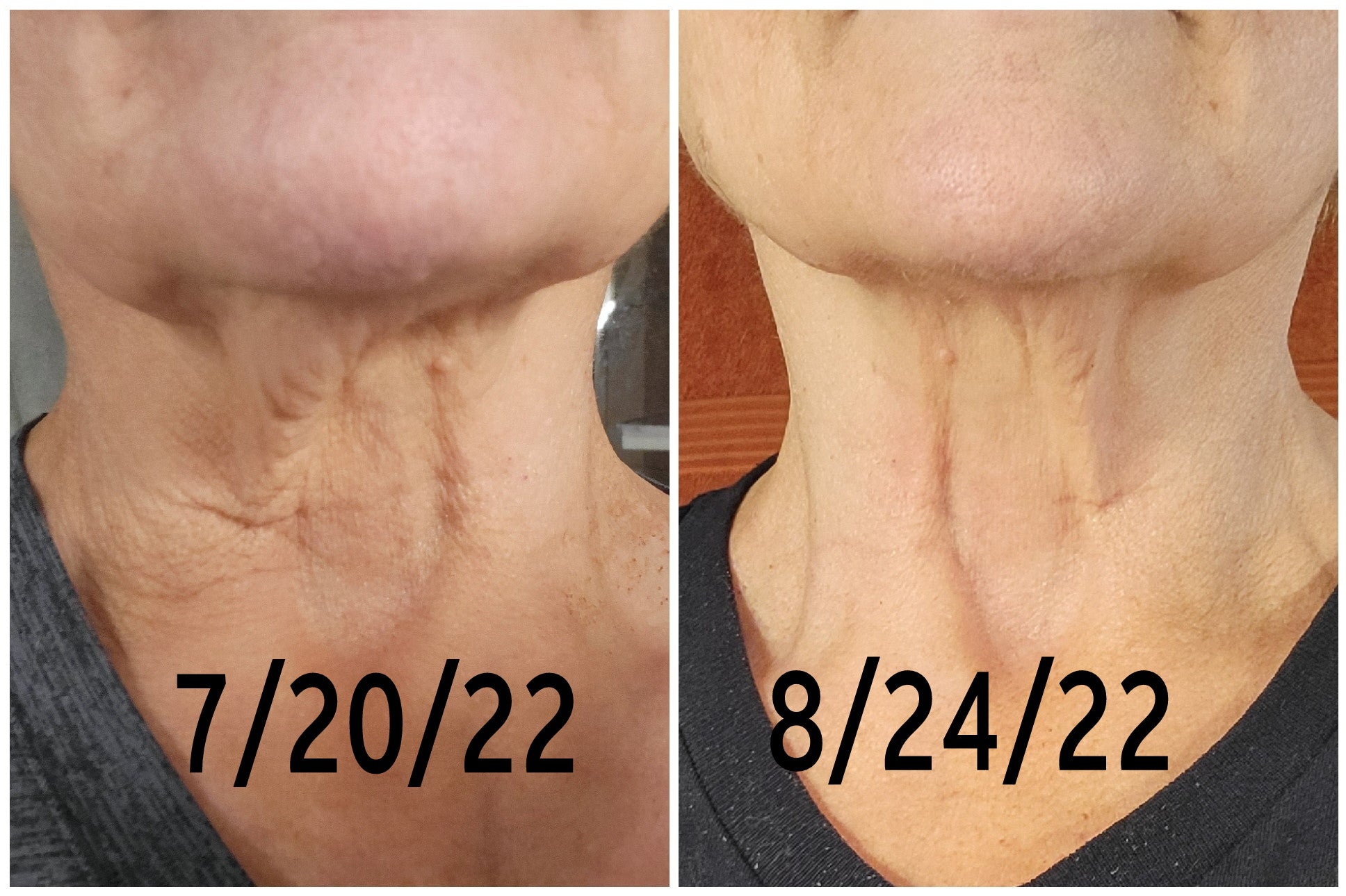 Crepey Skin Repair Cream | Liposomal Absorption | 4oz Jar | Hygieia ...