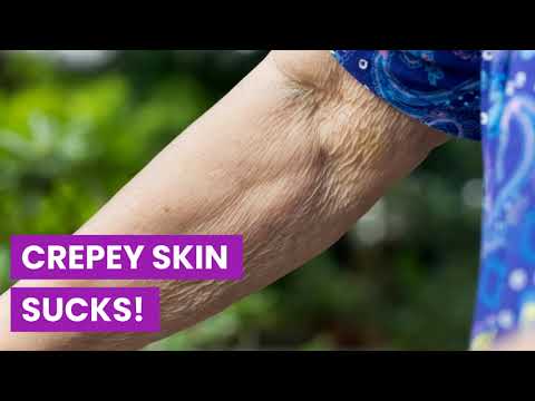 Crepey Skin Repair Cream | Liposomal Absorption | 4oz Jar | Hygieia ...